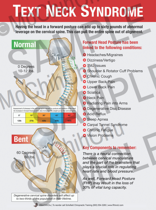 Text Neck Poster – Schofield Chiropractic Training